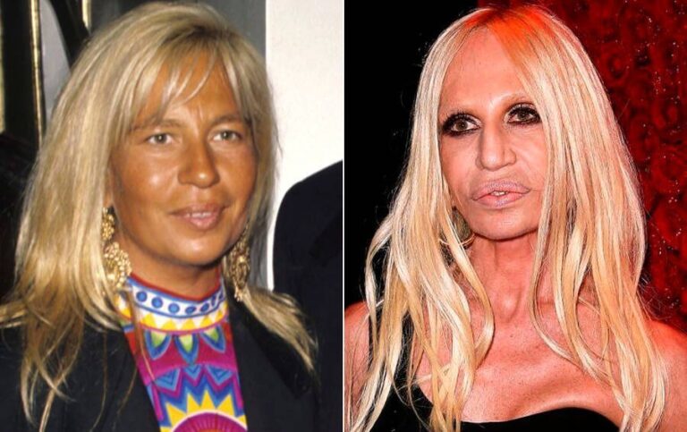 «They have changed incredibly after plastic surgery»: it is difficult ...