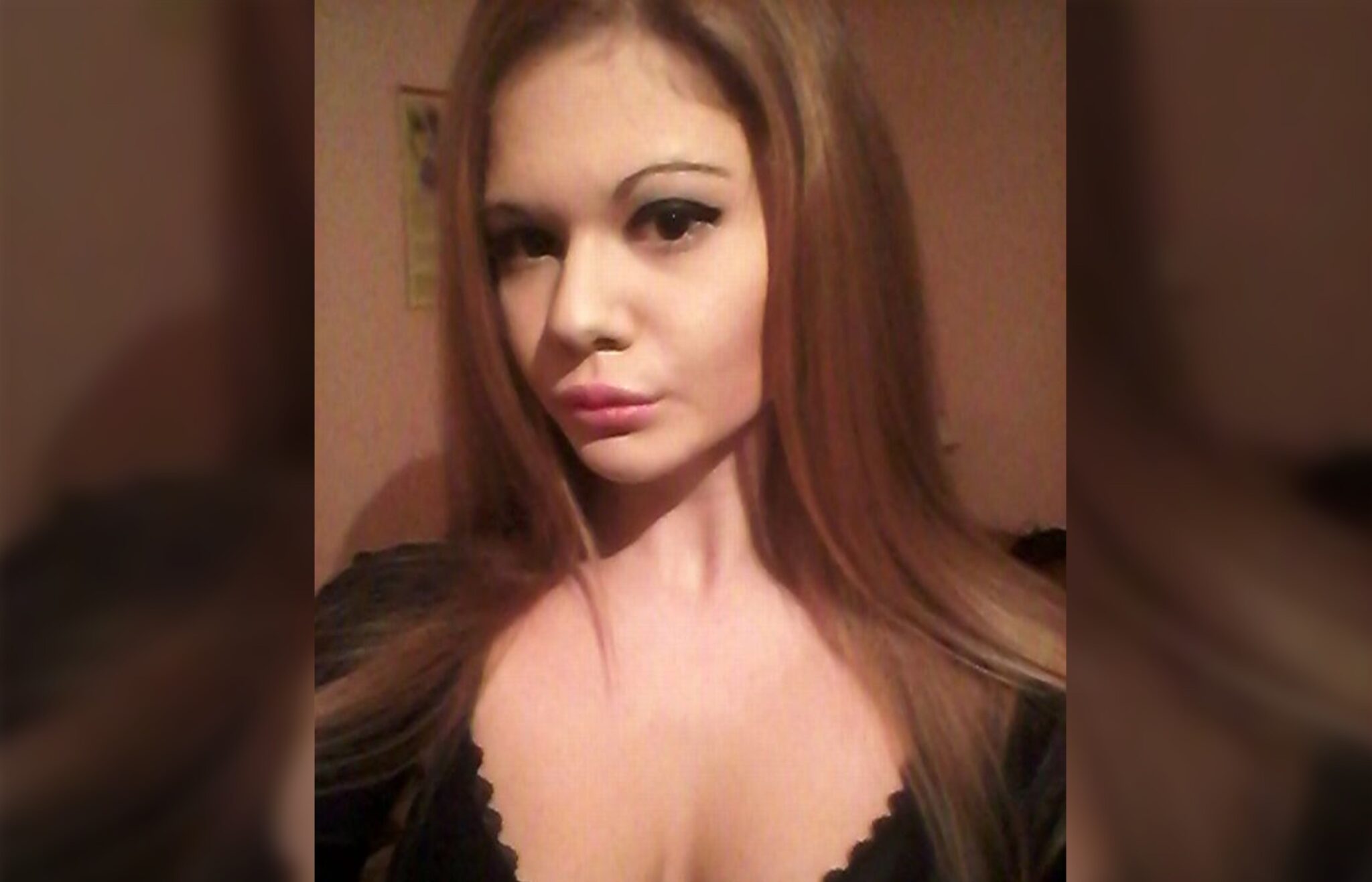 «Real-life Bratz now and then!» This is what the girl looked like before her plastic surgery ...