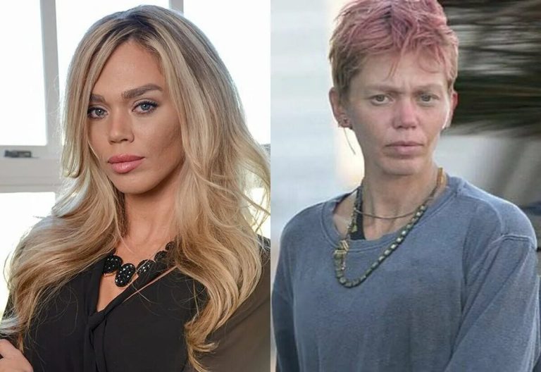 The Untold Story of Loni Willison’s Challenges with Addiction and the ...