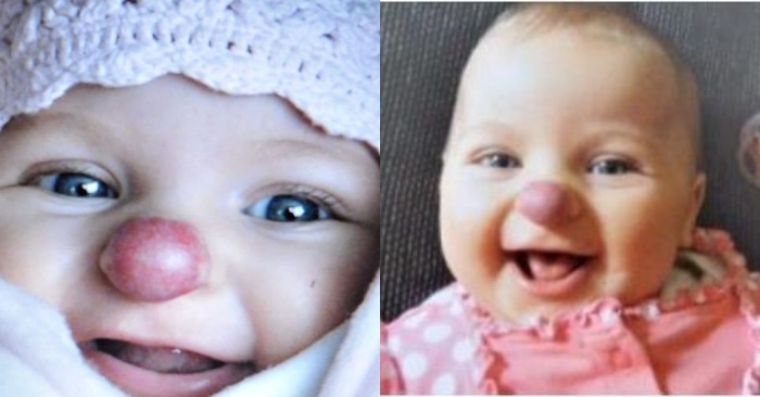 Quand cette fille est née, elle ressemblait à un petit pitre, avec une ...